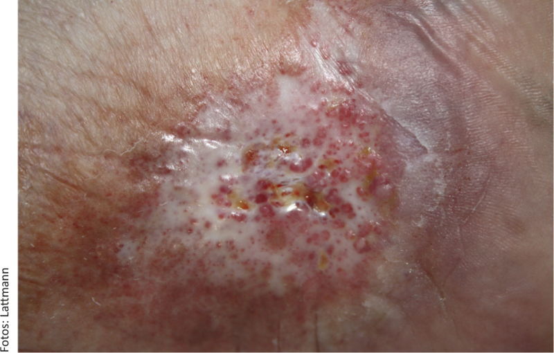 The three pillars of therapy - Medizinonline