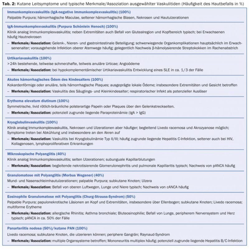 Vasculite cutânea - Visão geral para a prática - Medizinonline