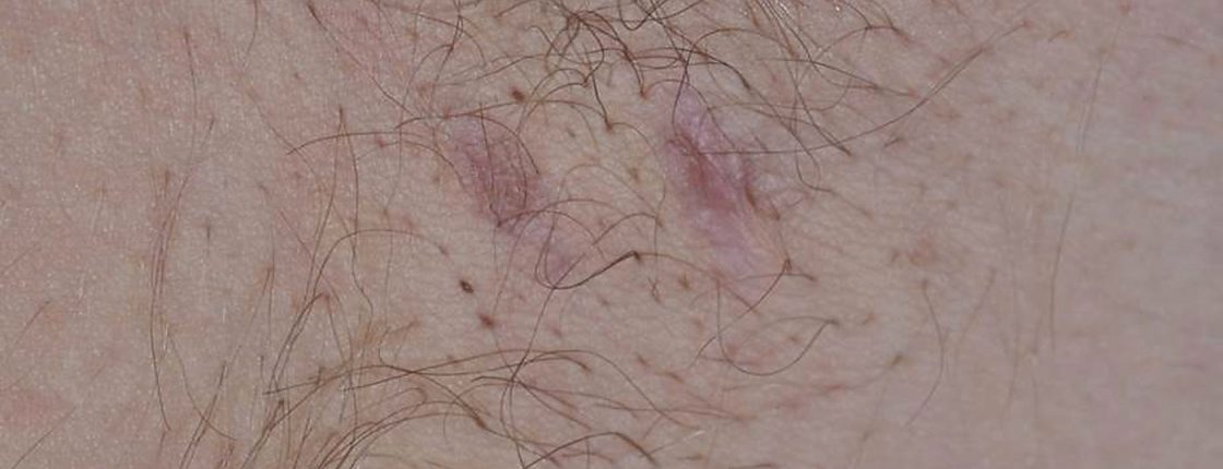 What are the surgical options? - Medizinonline