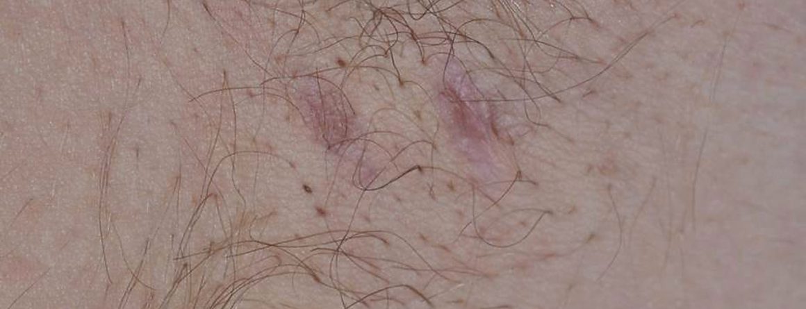 What are the surgical options? - Medizinonline