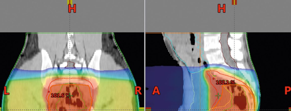 Multimodal therapy of rectal cancer - Medizinonline