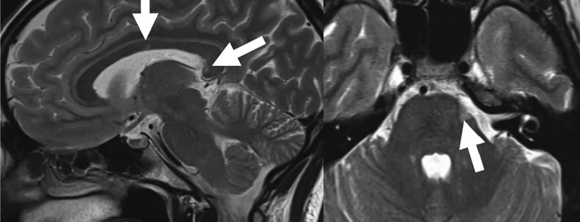 Classification systems enable precise classification - Medizinonline