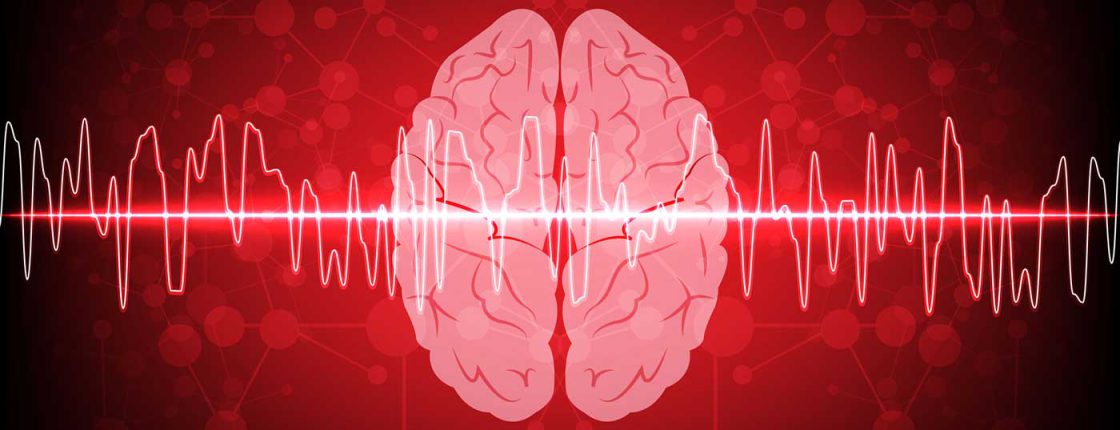 Tratamiento agudo del ictus isquémico - Medizinonline