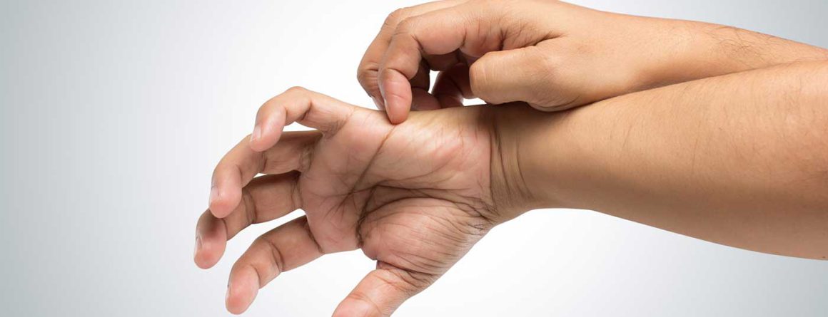 The chronic hand eczema - Medizinonline