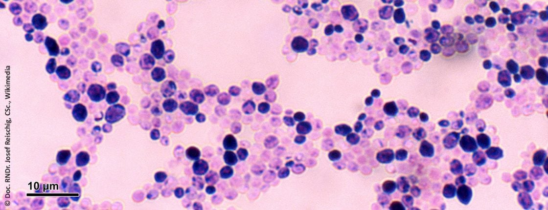 Candidiasis genital: diagnóstico y tratamiento - Medizinonline