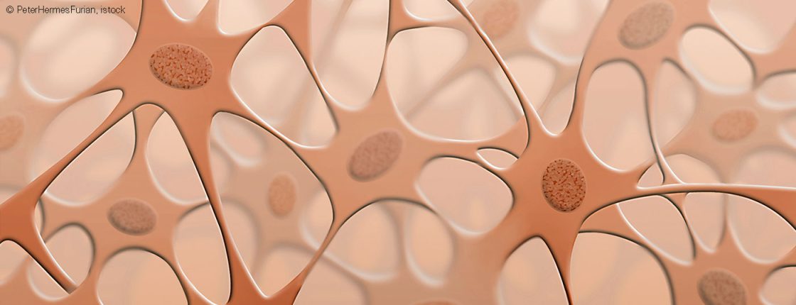 Systemic Scleroderma - Current Recommendations for Diagnosis and ...