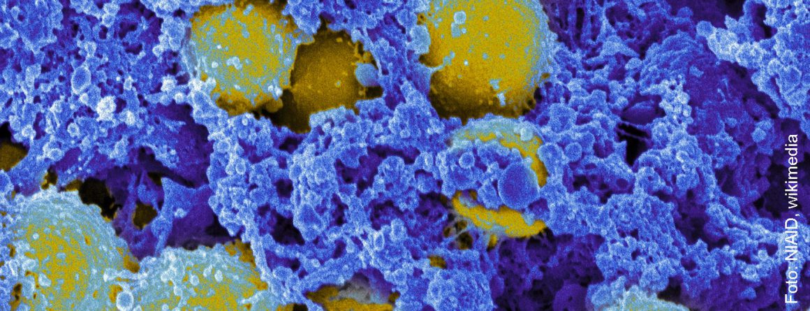 Host-microbiome interactions in atopic dermatitis. - Medizinonline