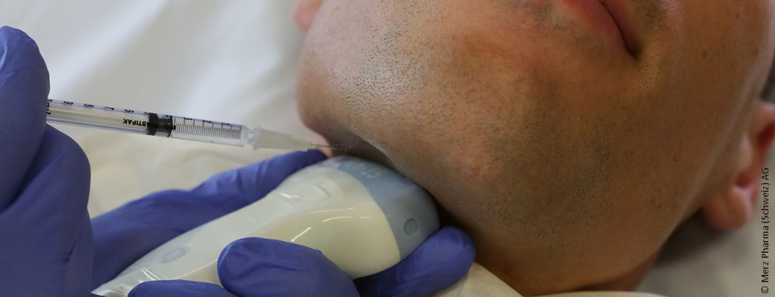 Approval: Ultrasound-guided injection of incobotulinumtoxinA ...