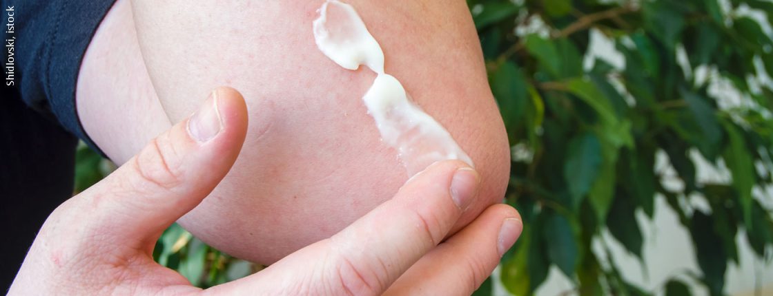 Ventajas de la farmacoterapia tópica - Medizinonline