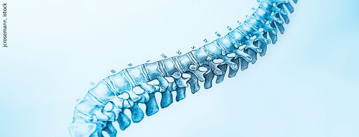 Lumbalgie: Pseudospondylolisthese – klinische Merkmale segmentaler ...