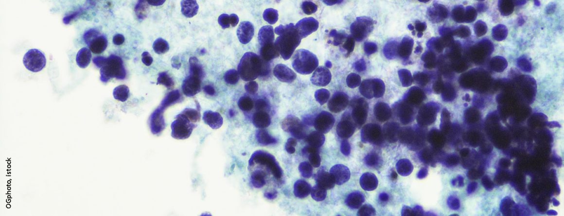 First targeted substance in KRAS mutation and bispecific immunotherapy ...