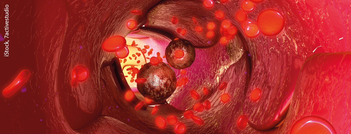 Seraph 100" adsorber from Exthera Medical expands product range ...