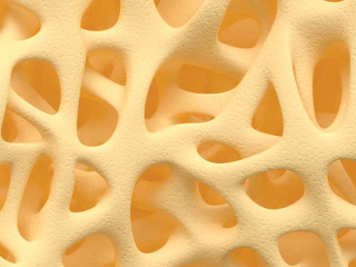 El pie diabético infectado - diagnóstico y tratamiento - Medizinonline