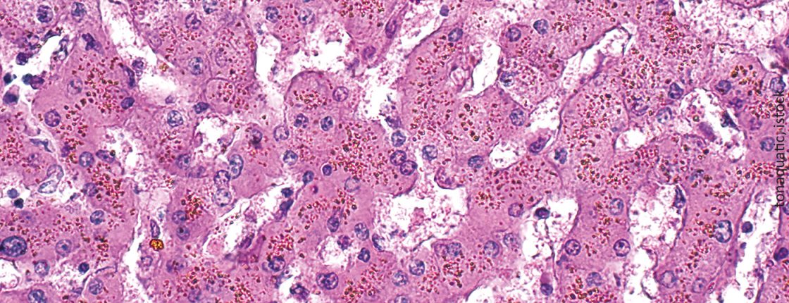 Fisiopatología y clínica - Medizinonline