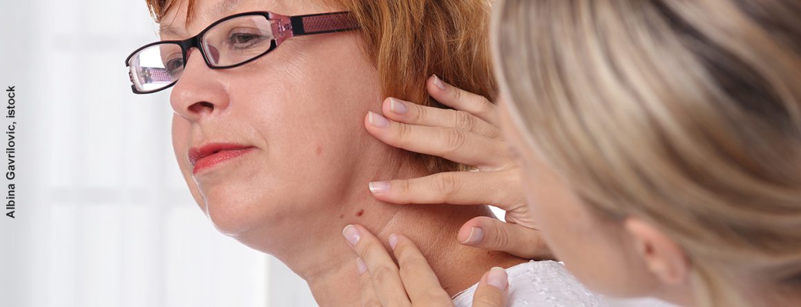 Atypical fibroxanthomas and the pleomorphic dermal sarcoma. - Medizinonline