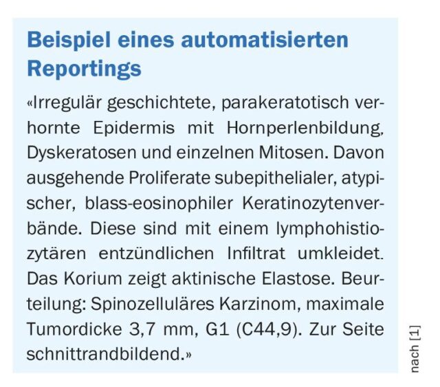 Deep learning algorithm to accelerate dermatopathology assessment ...