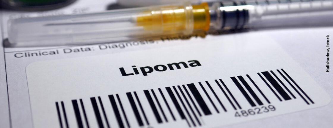 dysphagia - cervical and intrathoracic lipoma - Medizinonline