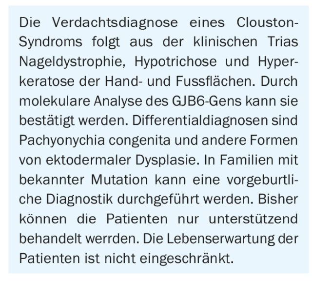 Síndrome de Clouston: una displasia ectodérmica hidrótica - Medizinonline