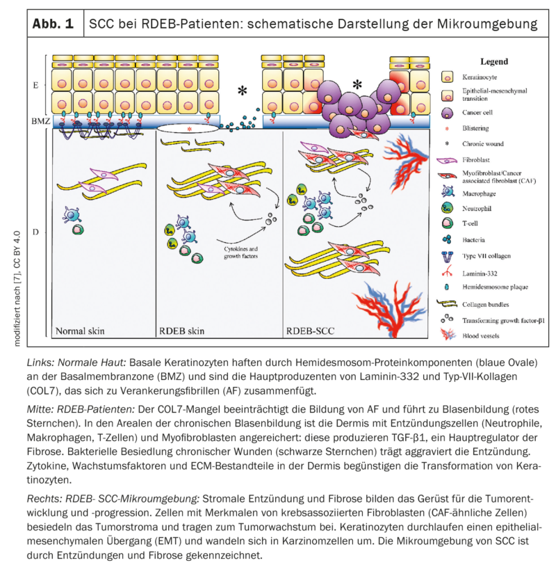 Wound chronicity and tumorigenesis - relevance of T cell-mediated ...