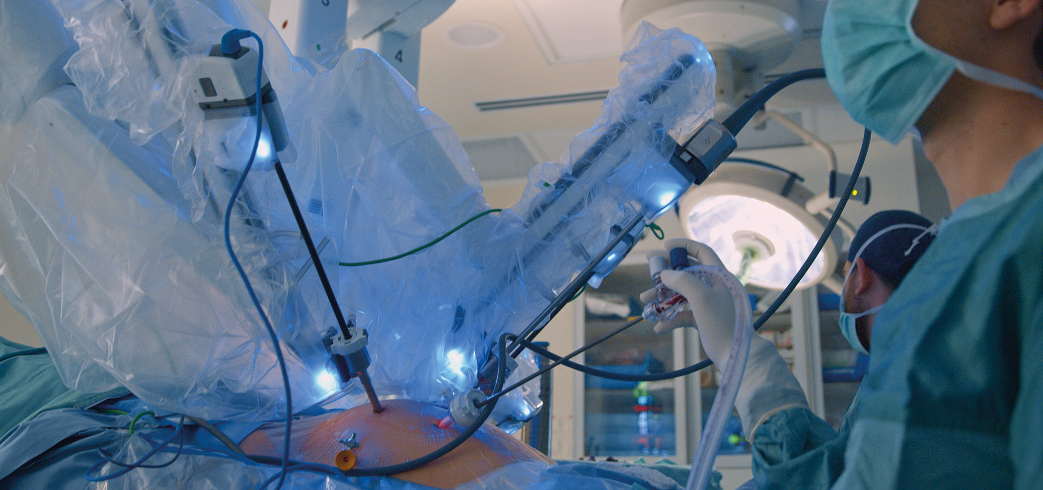 Upper gastrointestinal tract and robotic visceral surgery - Medizinonline