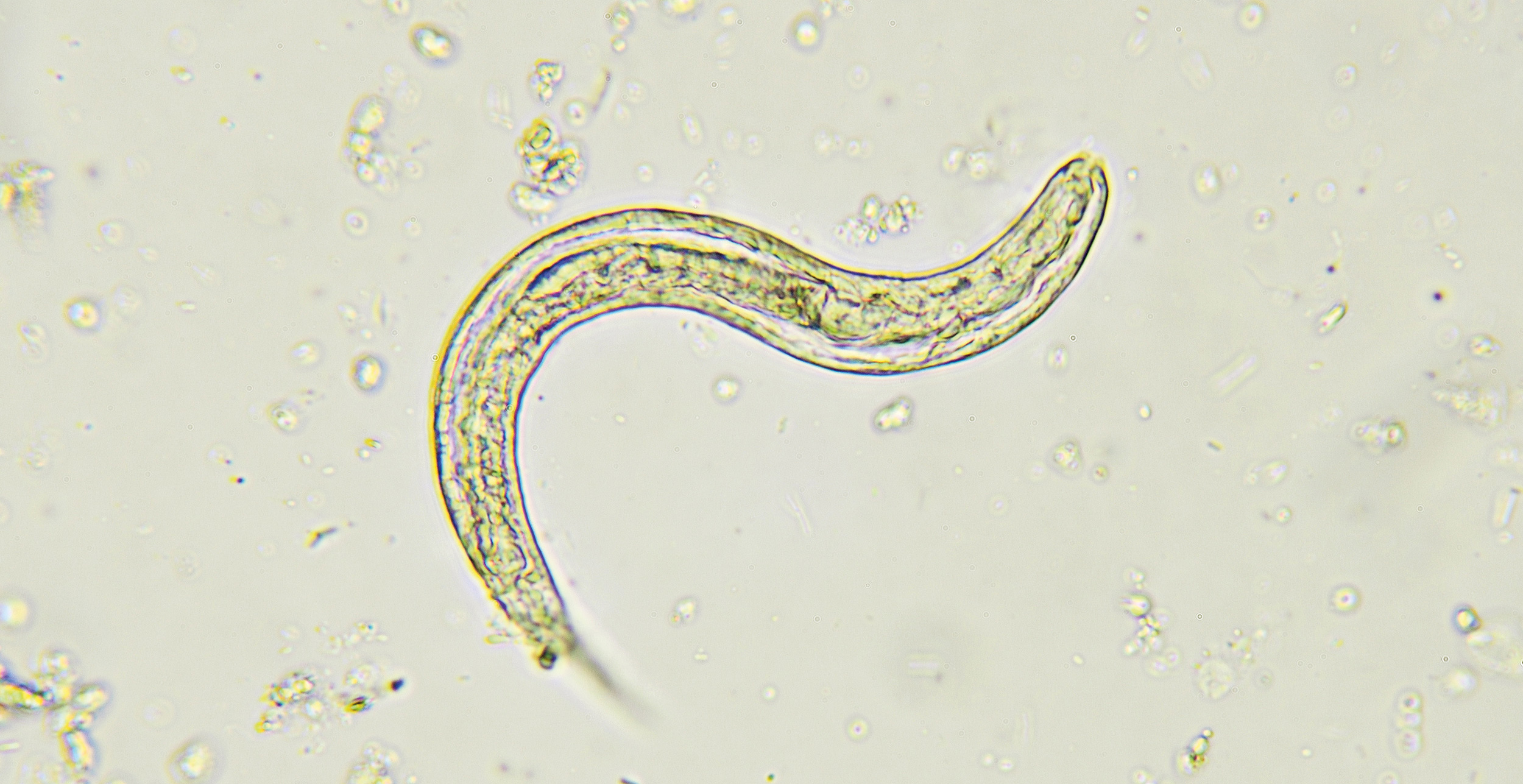 El gusano enano causa dolor gastrointestinal - Medizinonline