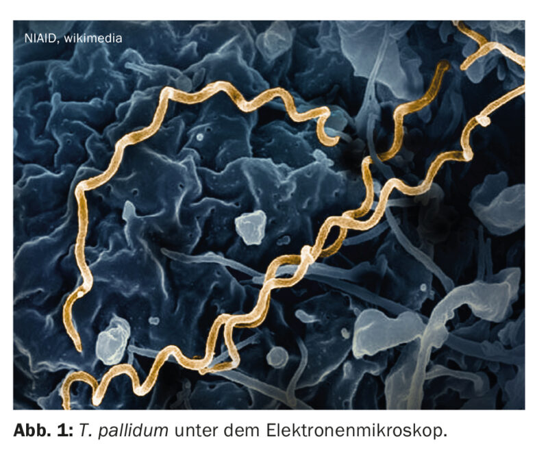 The DD ranges from herpes simplex to ulcus vulvae acutum - Medizinonline