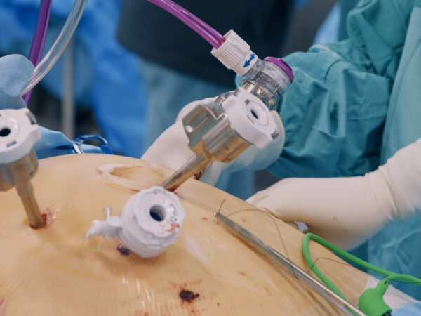 Agonista dual de los receptores GIP/GLP-1 como opción terapéutica ...