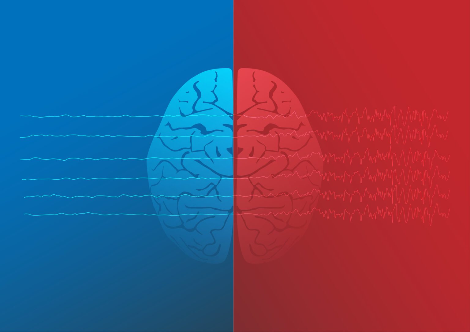 Die Behandlung des refraktären Status epilepticus – eine Übersicht ...