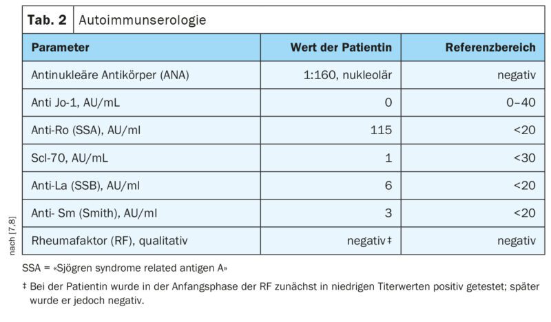Calcinosis cutis in a patient with Sjögren's syndrome - Medizinonline