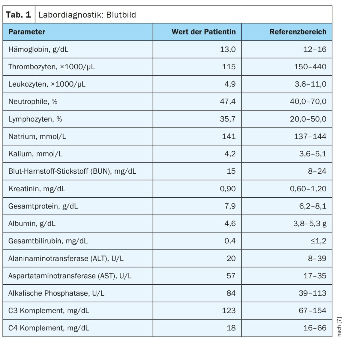 Calcinosis cutis in a patient with Sjögren's syndrome - Medizinonline