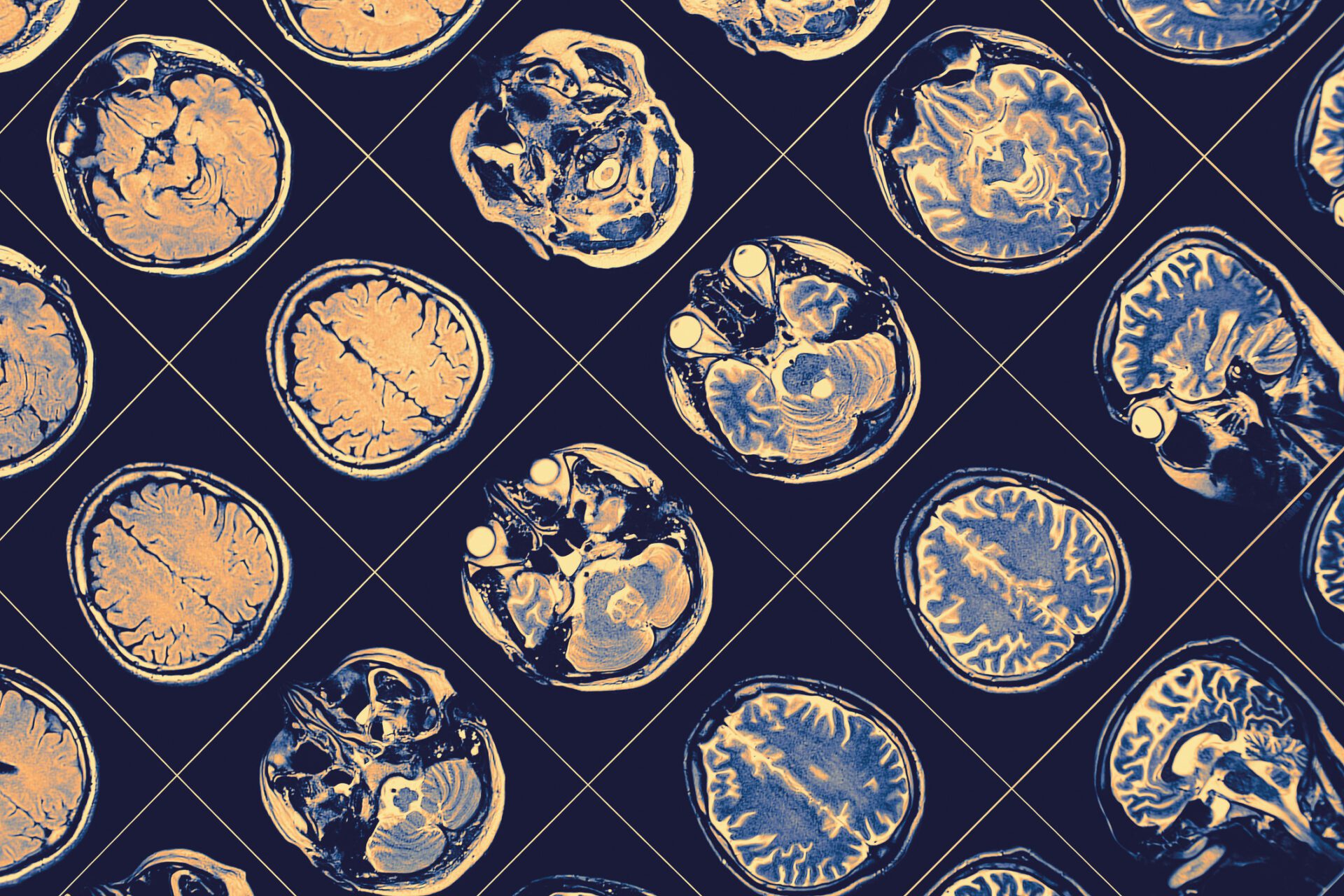 DRESS-Syndrom – Aktuelles zu Diagnostik und Therapie - Medizinonline